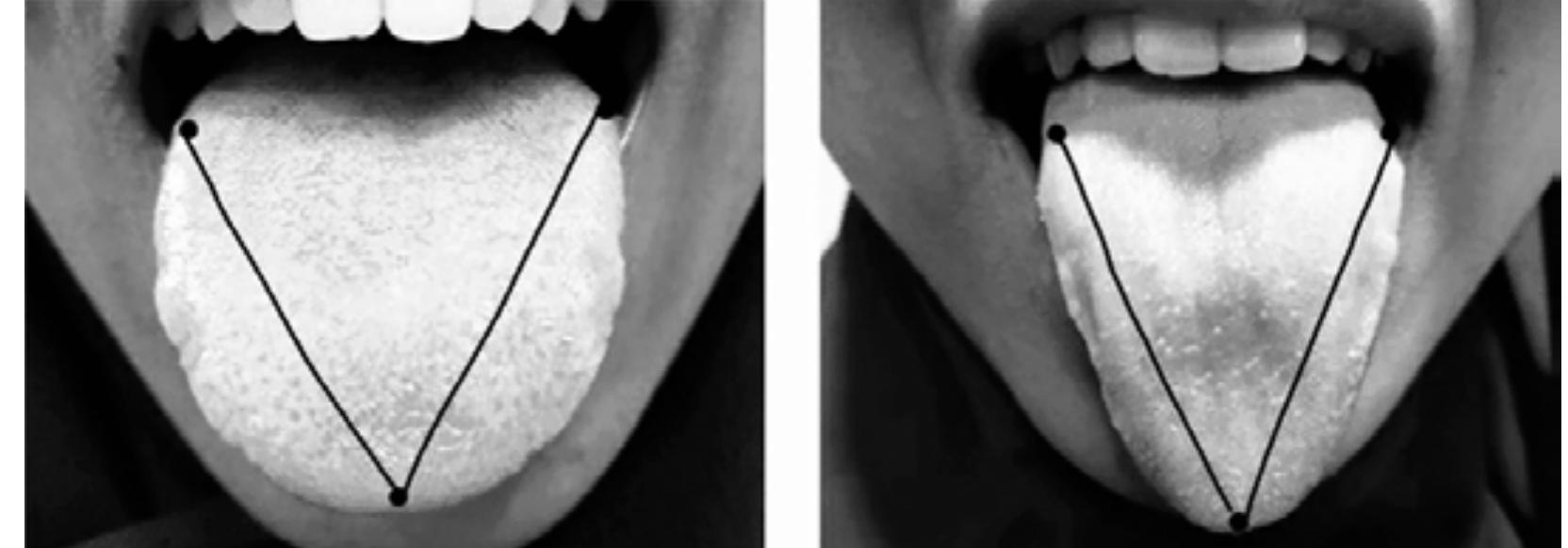 Reference points on tongue for shape determination 24
