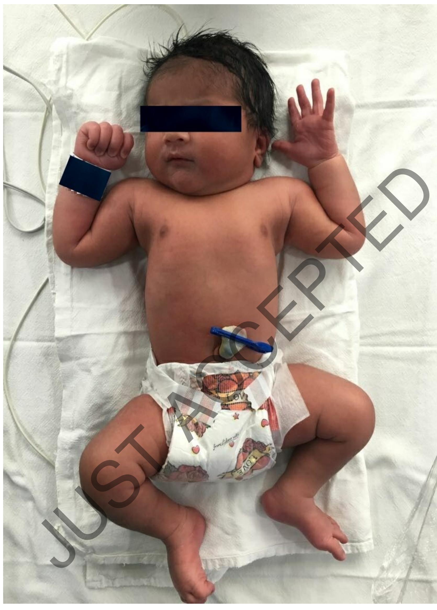 Figure 3 - Infant of diabetic mother: what one needs to