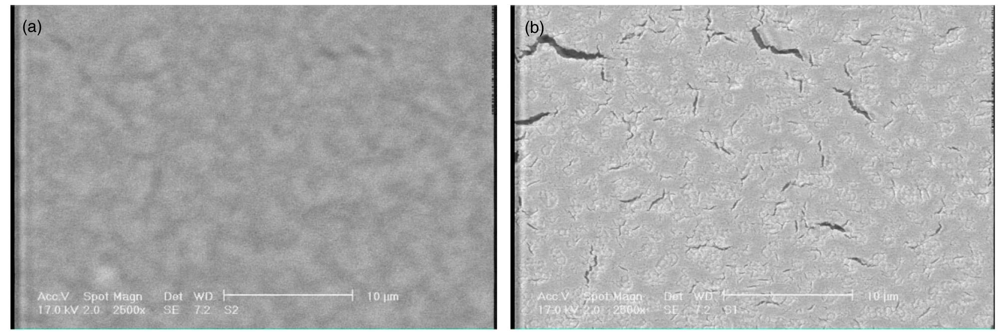 Scanning electron microscope microstructure of (a) whey and