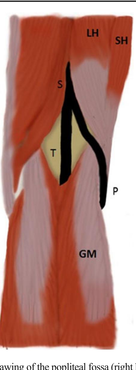 Figure 2 - Peroneal nerve: Normal anatomy and pathologic