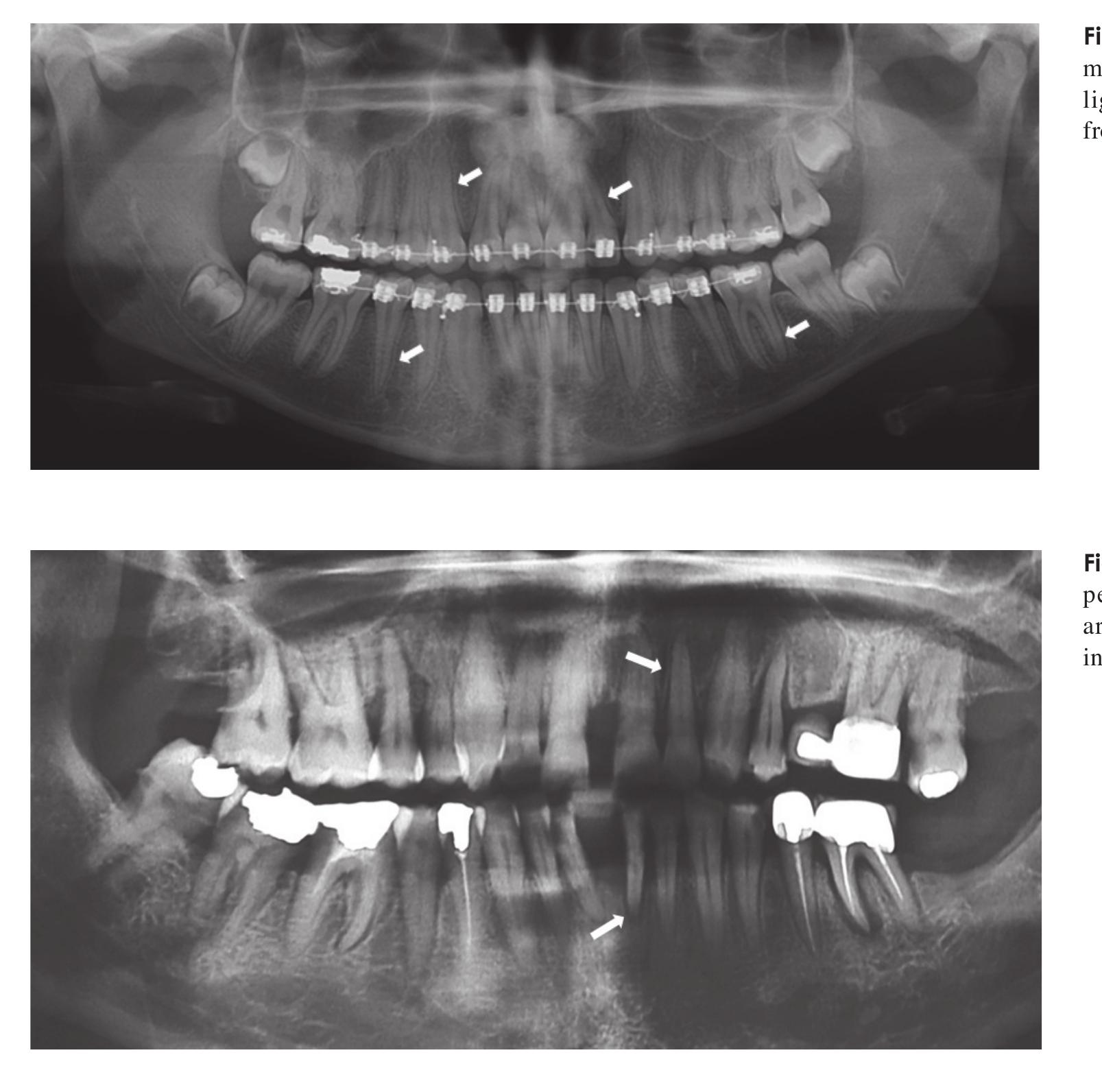 (PDF) Review of common conditions associated with periodontal ligament ...