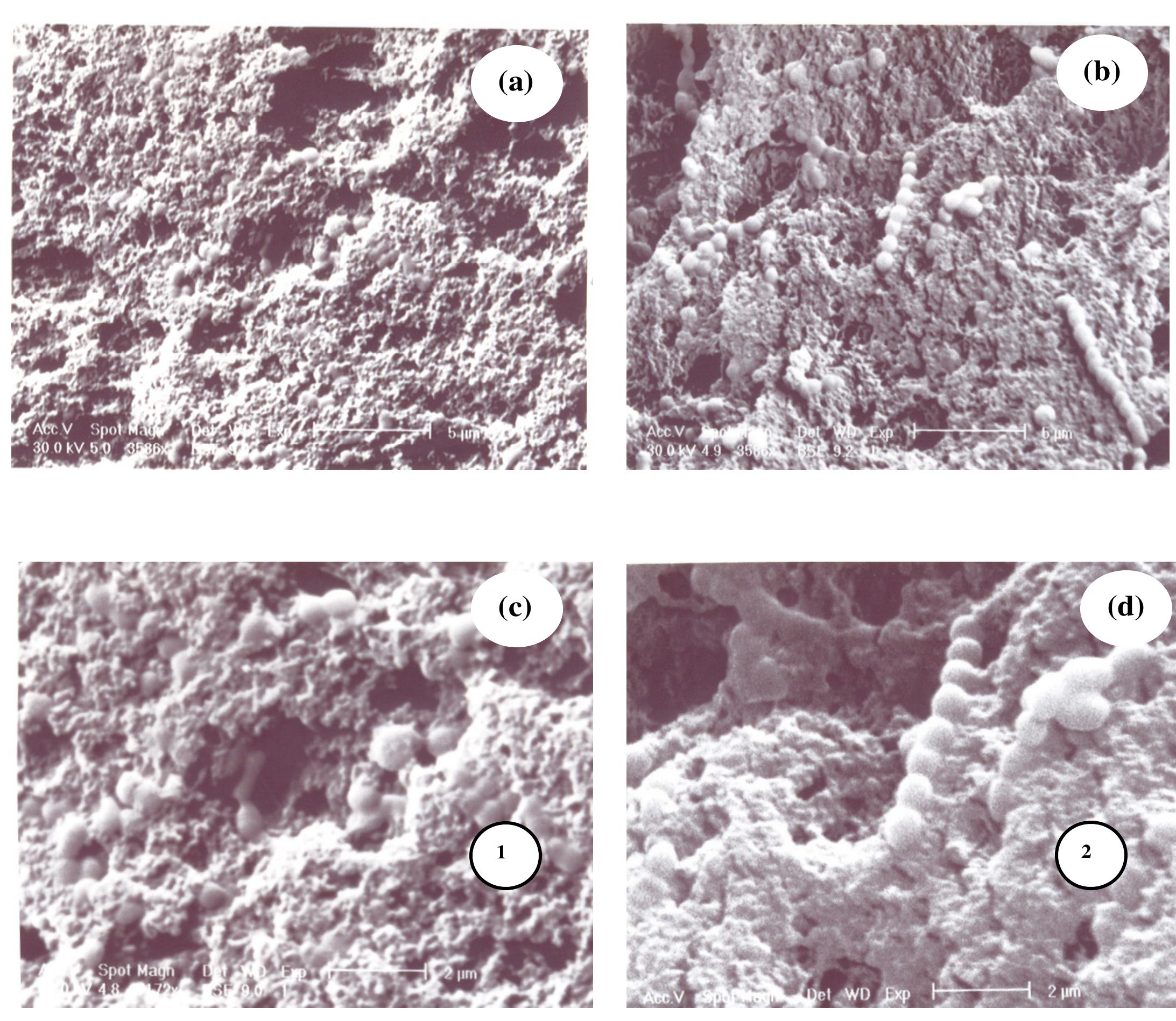 Sem micrographs of ilts: (a) scale bar = 5 um; (c) scale bar