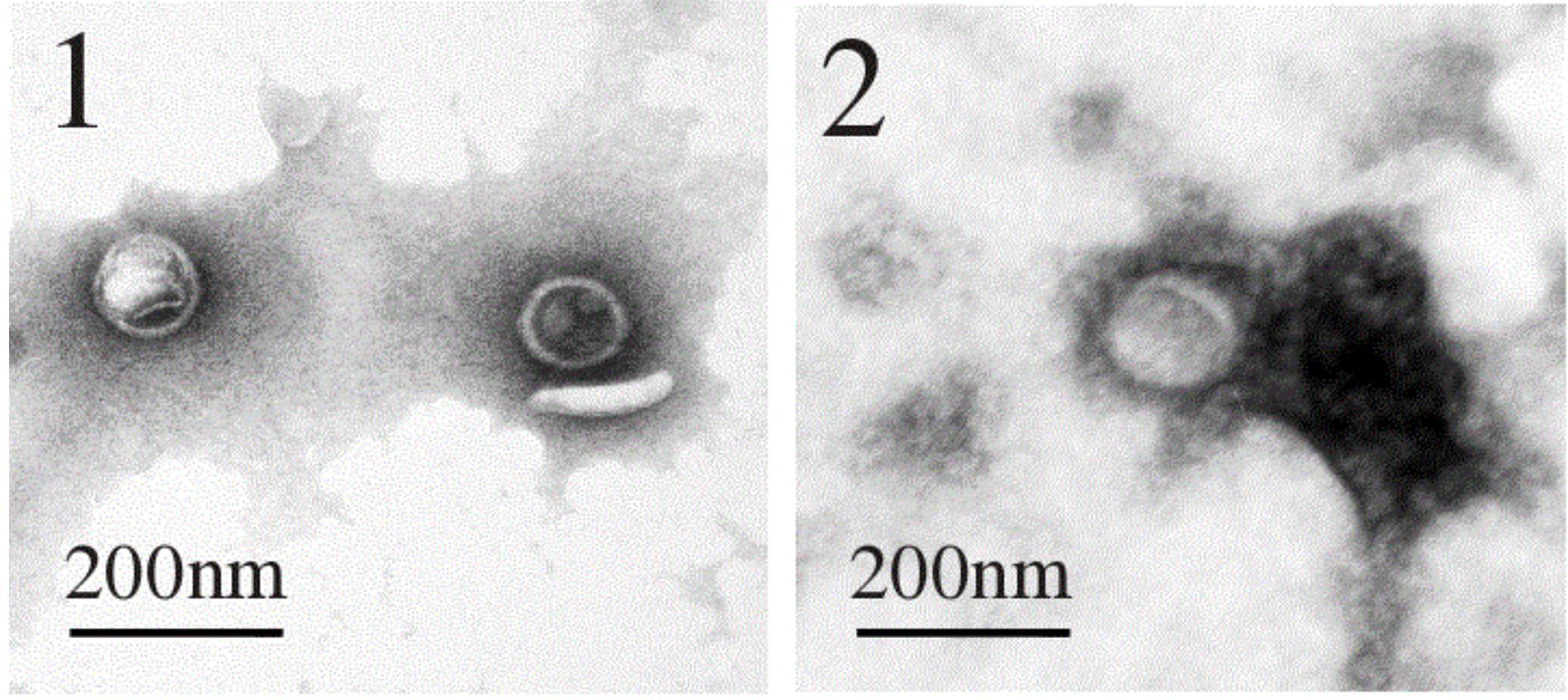 Igure 2 h. pylori phage phihp33 induced by uv exposition