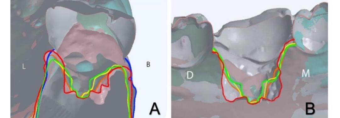 Transformed into cone-shaped according to the shape of cha.