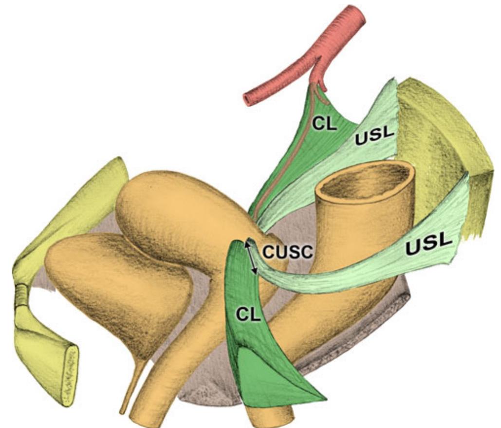 A schematic diagram of the cardinal ligament (cl; dark