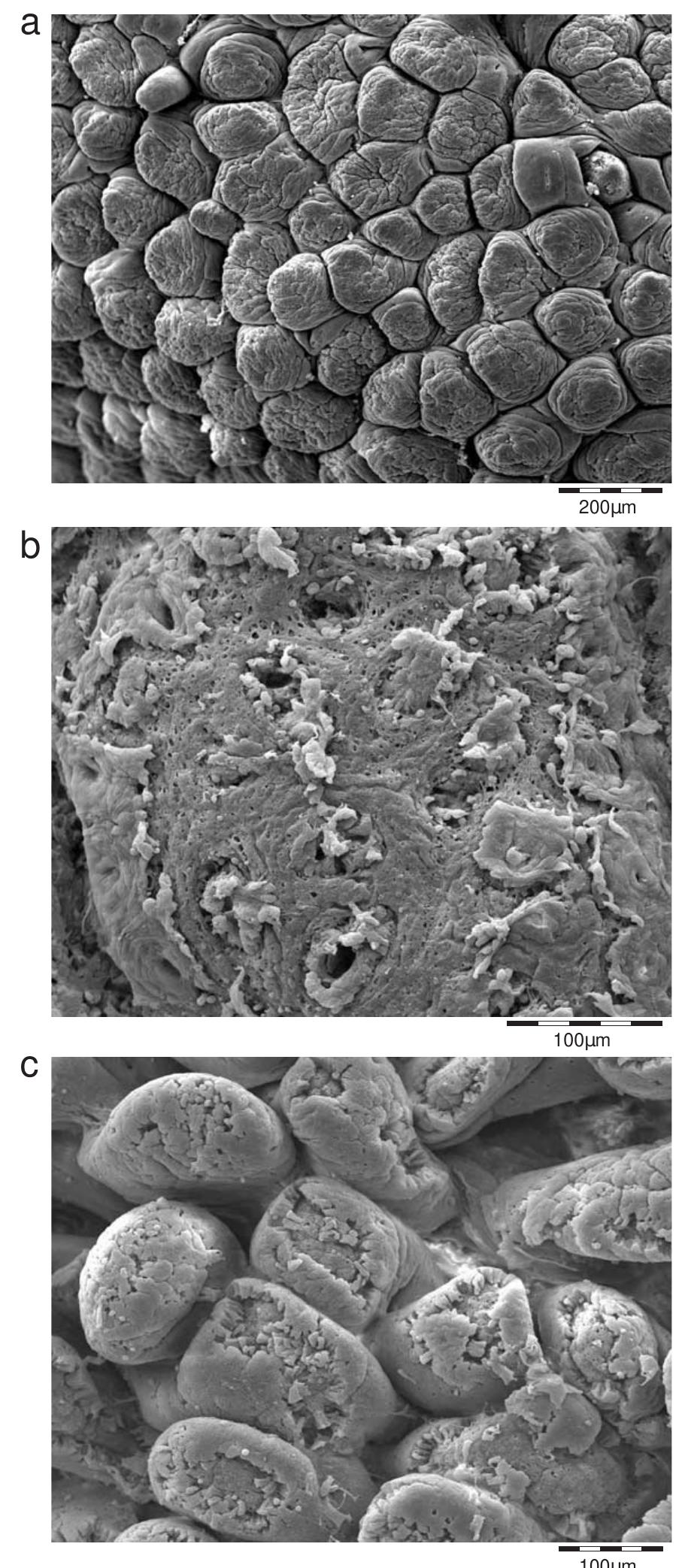 Electron microscopical findings. (a) normal appearance of