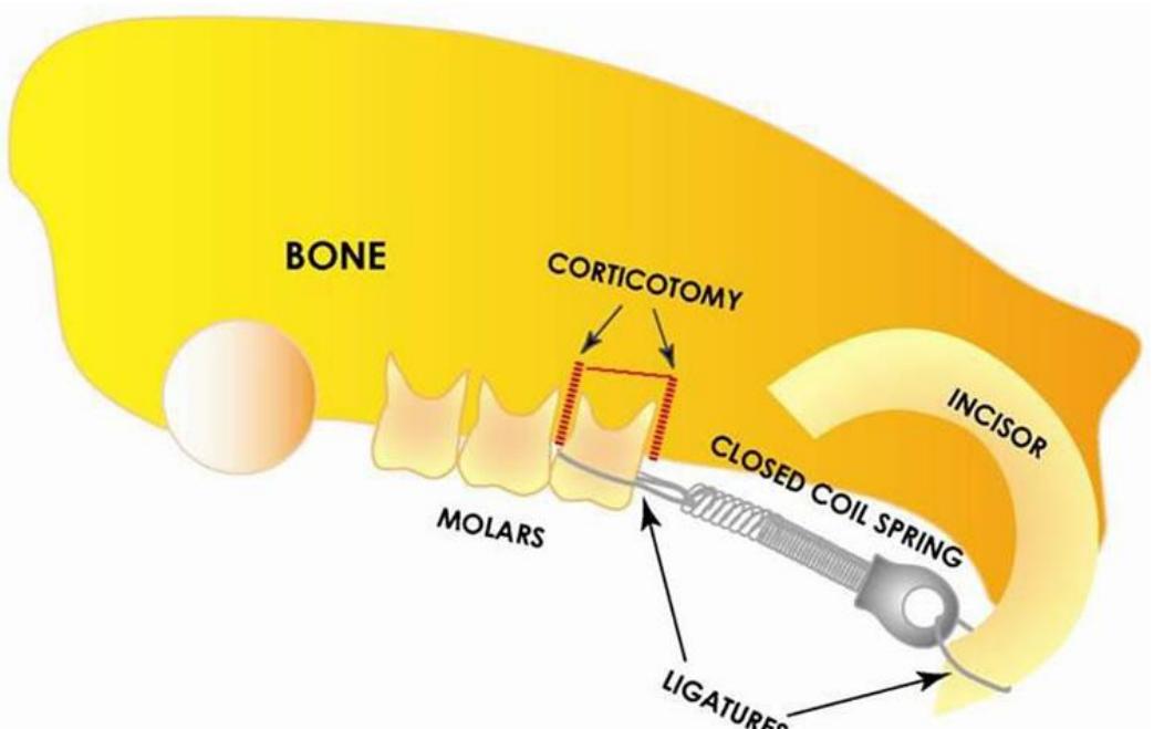 Schematic of the corticotomy procedure. a, sagittal view. b,