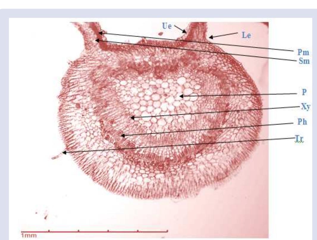 Photomicrograph showing the transverse section of the leaf