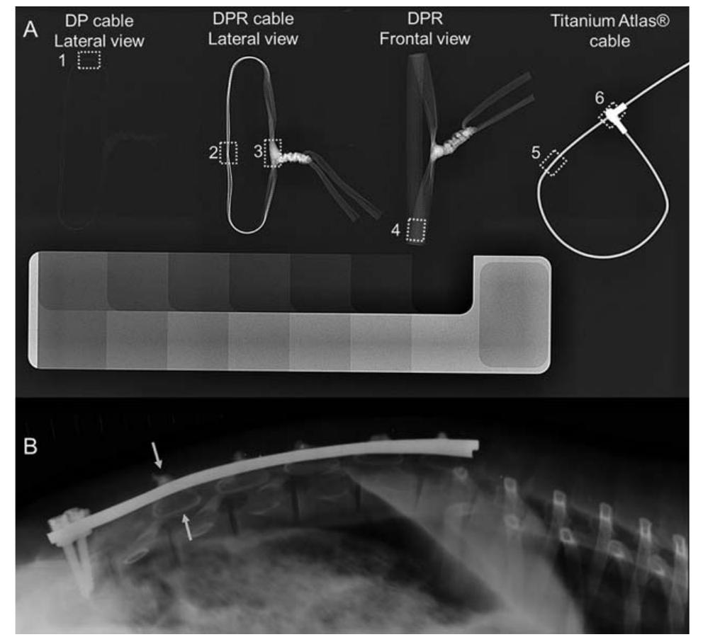 (a) radiograph (45 kv 4.2 mas) comparing the radiopacity of