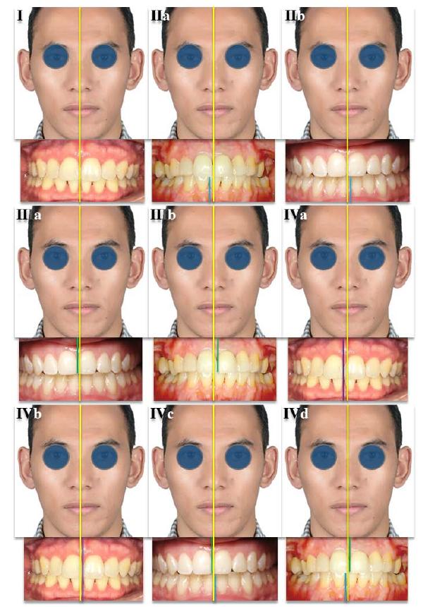 (1). the diagrammatic representation of classification of