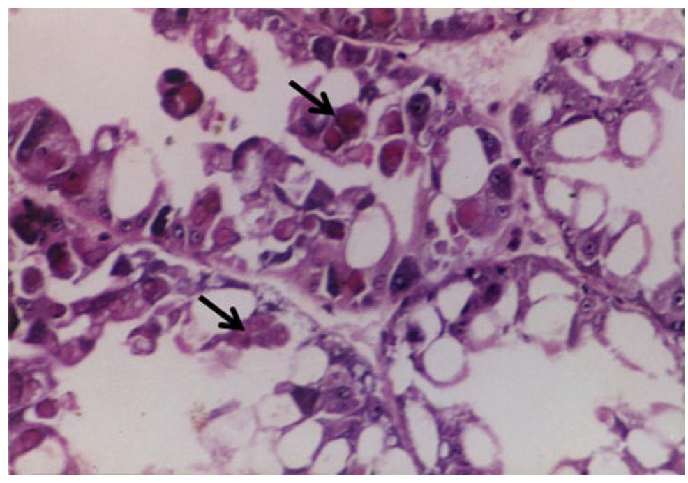 Histological section of hepatopancreas of penaeus monodon