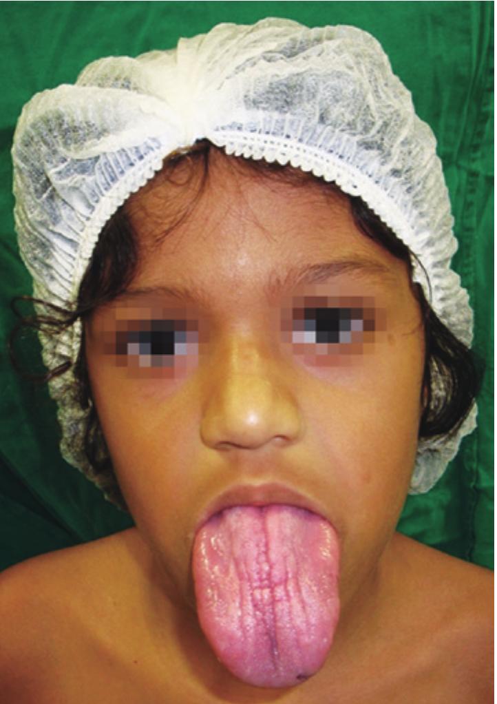 preoperative condition.