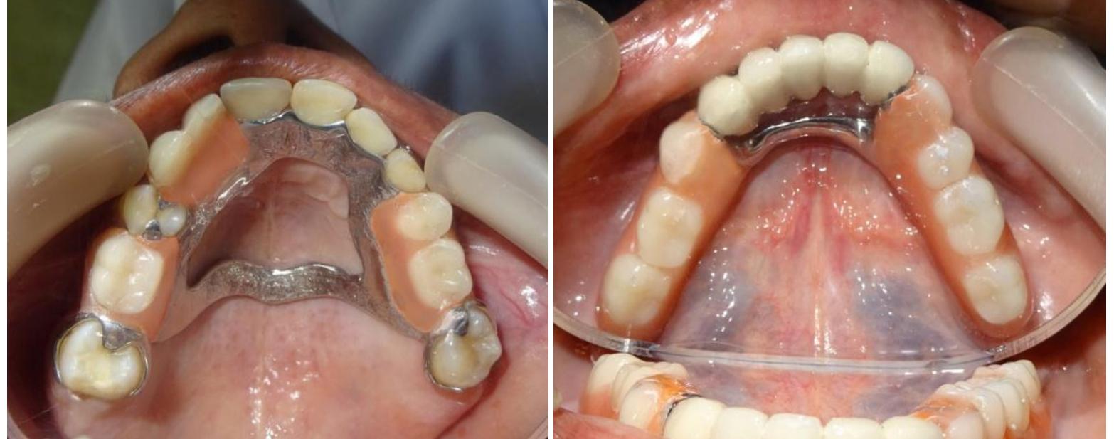 _ fig.7 b. post-operative intraoral mandibular view fig.7