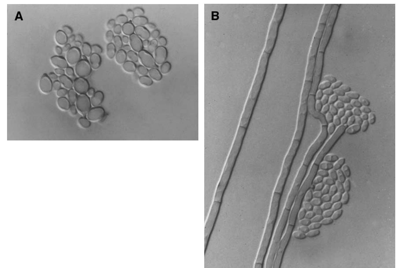 Micromorphology of exophiala jeanselmei during the