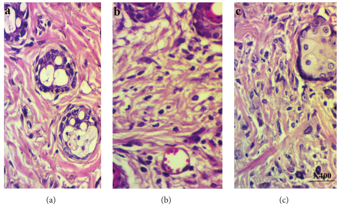 Microscopic views of dermis shows (a): the dermis of control