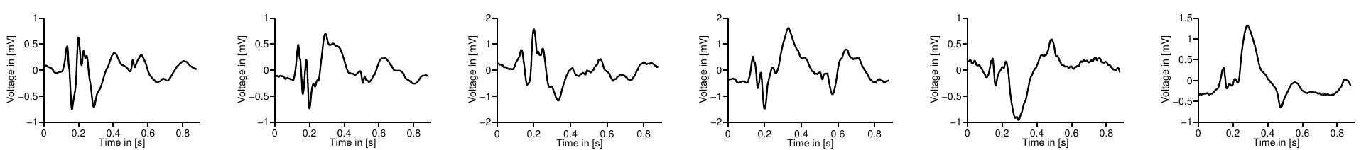 (a)head first, ecg sig- (b)feet first, ecg sig- (c)head