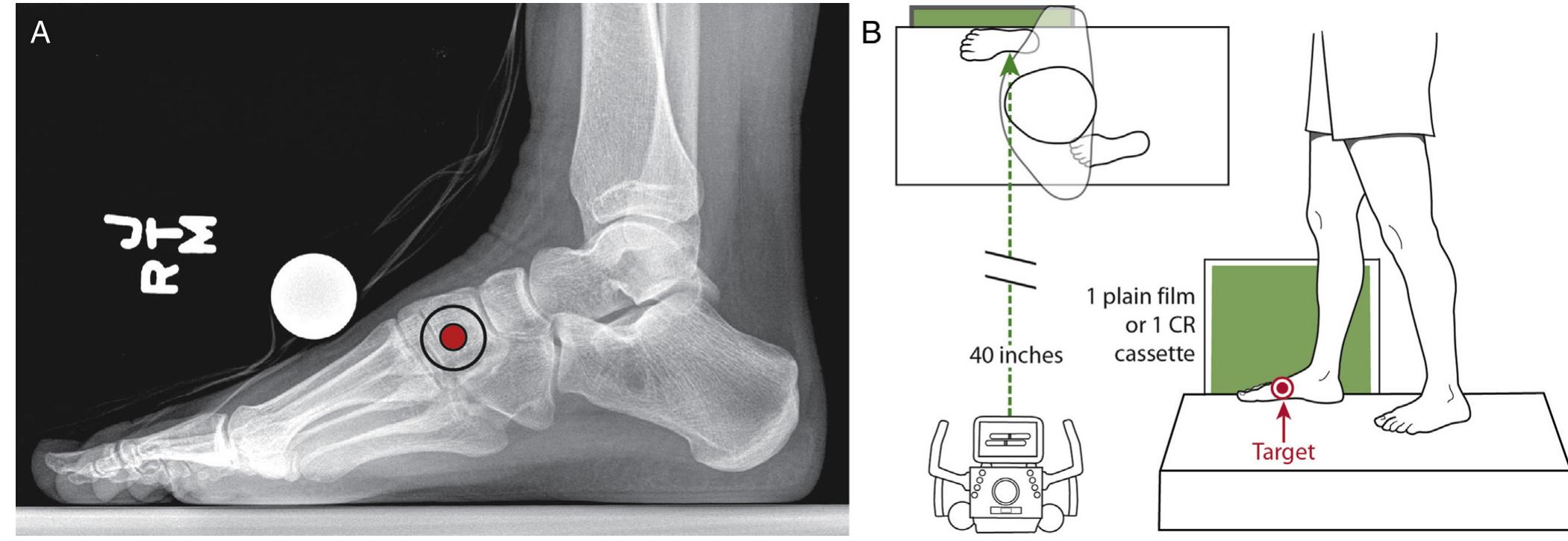(PDF) Normal Foot and Ankle Radiographic Angles, Measurements, and ...