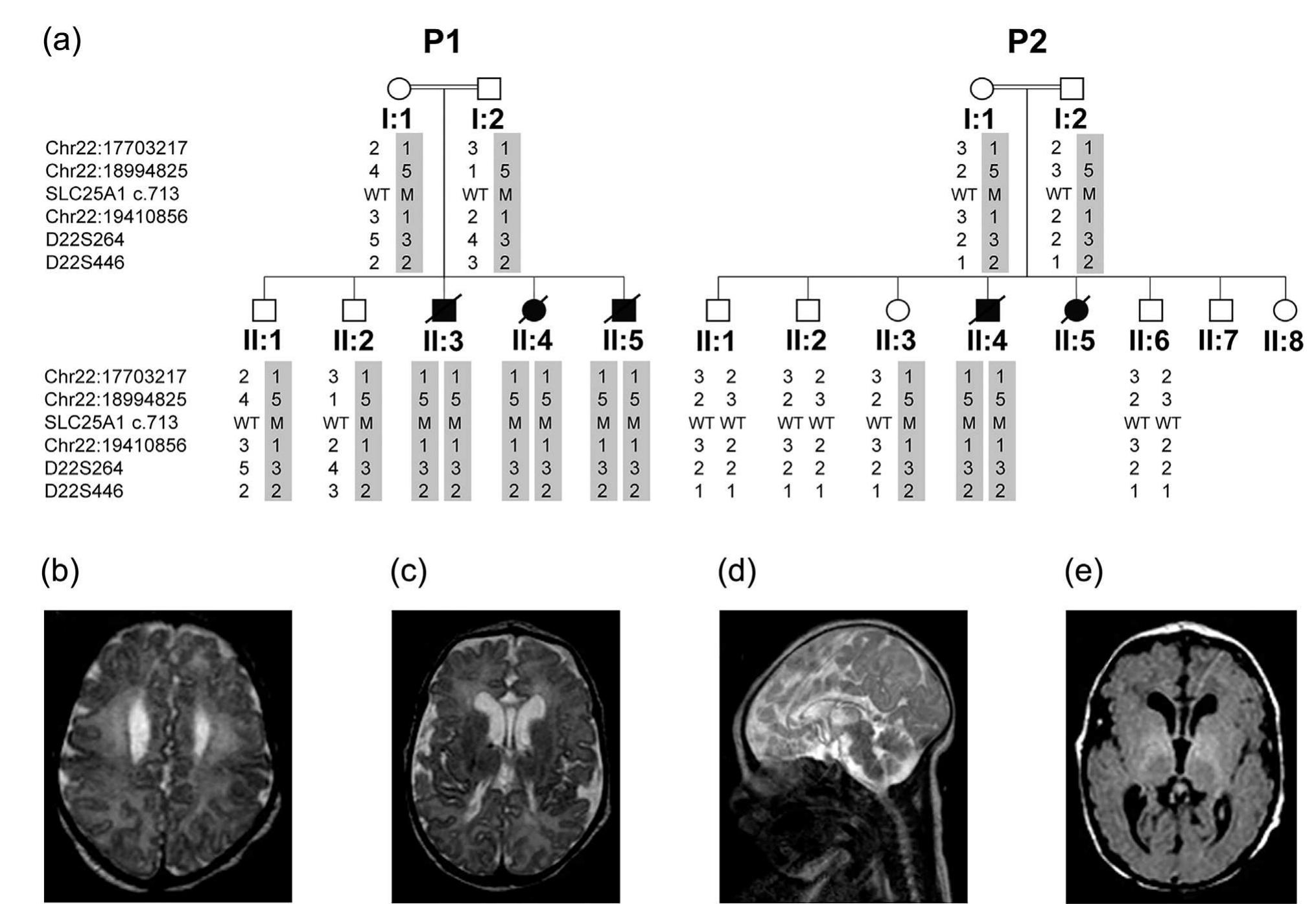 Pedigree and disease phenotype: (a) family tree with