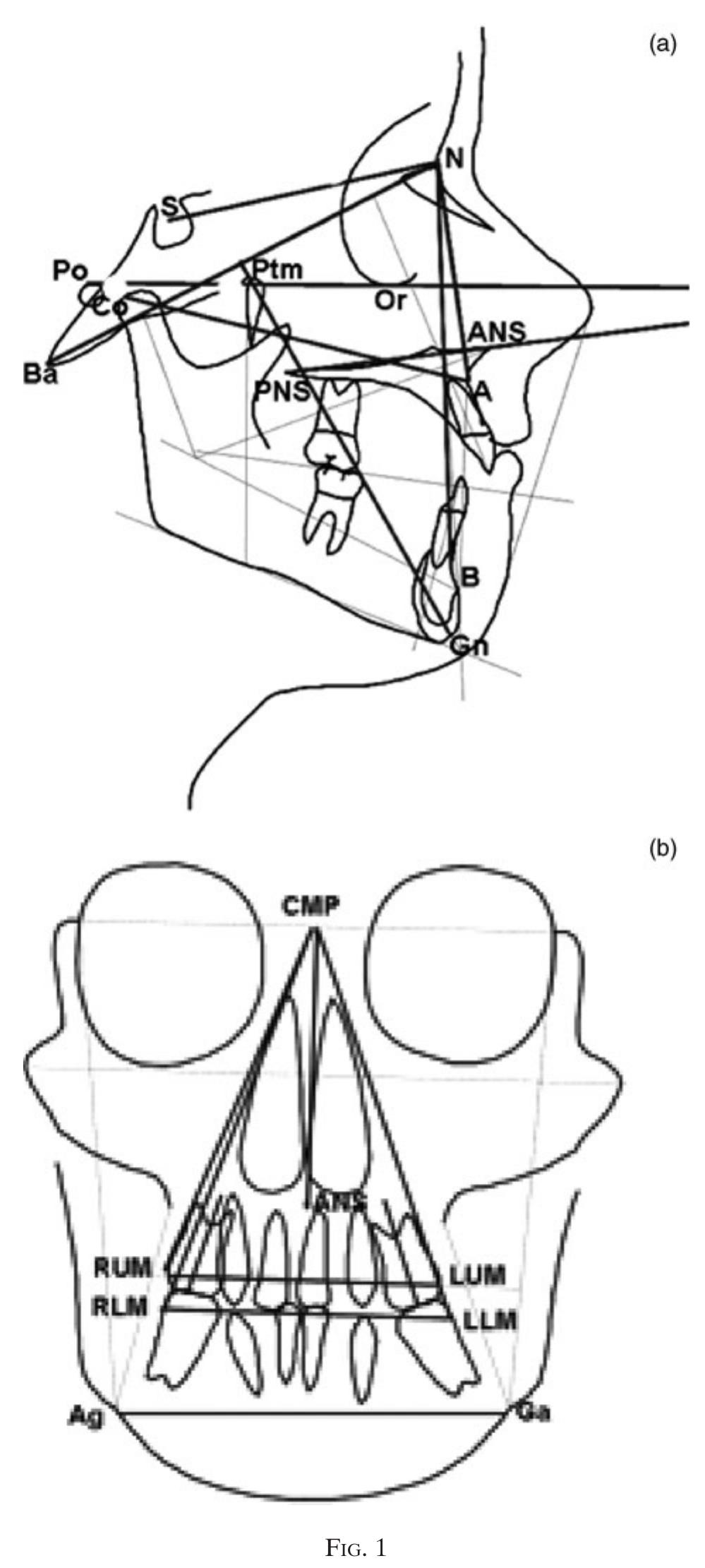 (a) lateral and (b) posteroanterior cephalometric diagrams