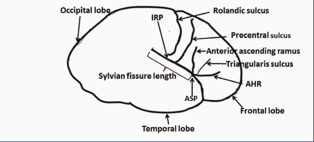[table/fig-1]: illustration of the lateral surface of the
