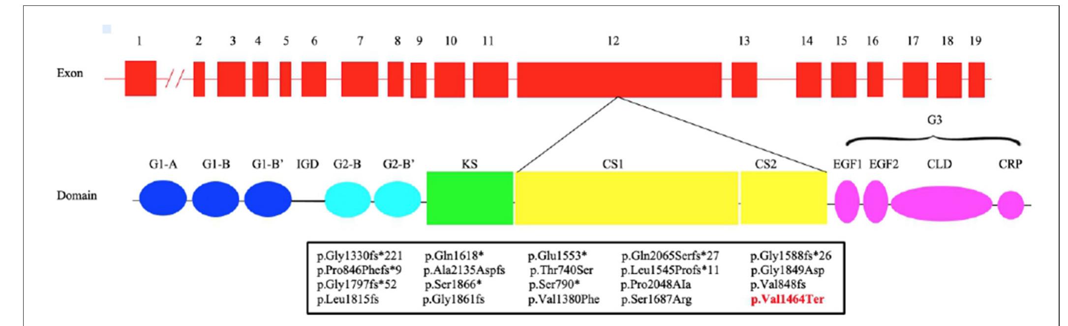 | structure of acan gene and aggrecan protein. pathogenic
