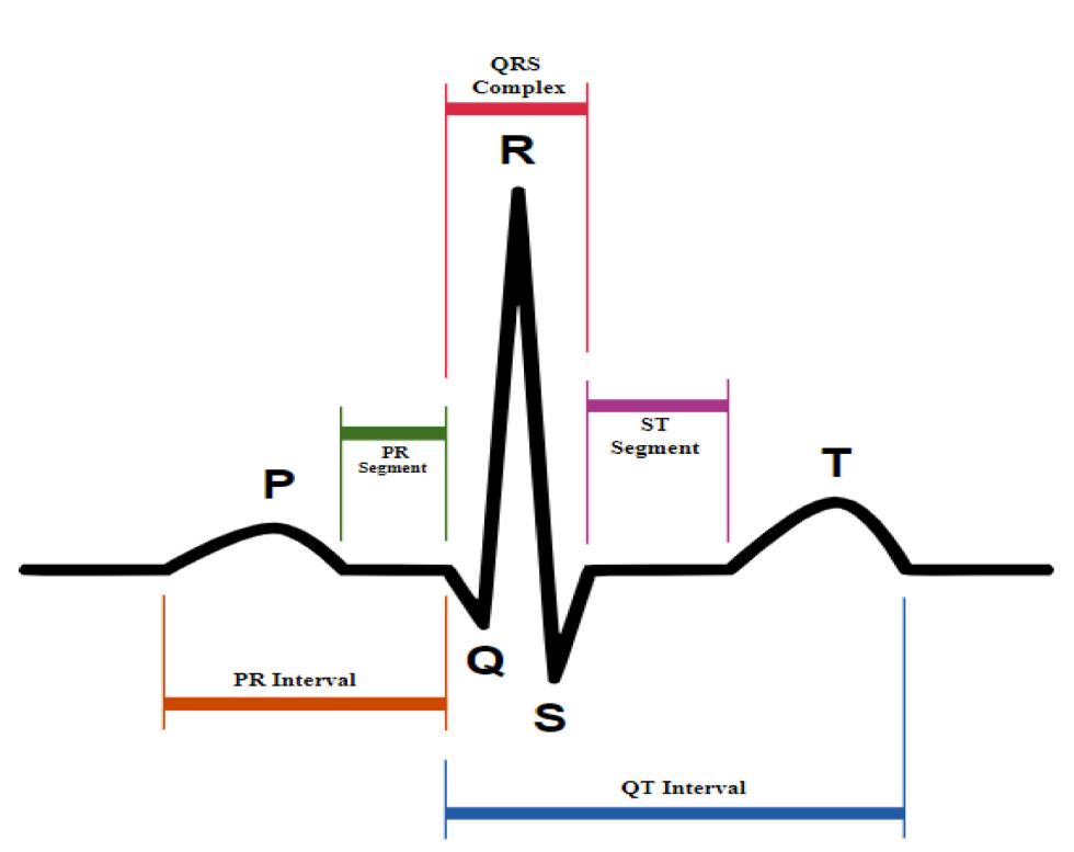 Normal ecg signal and its components real -time ecg signal