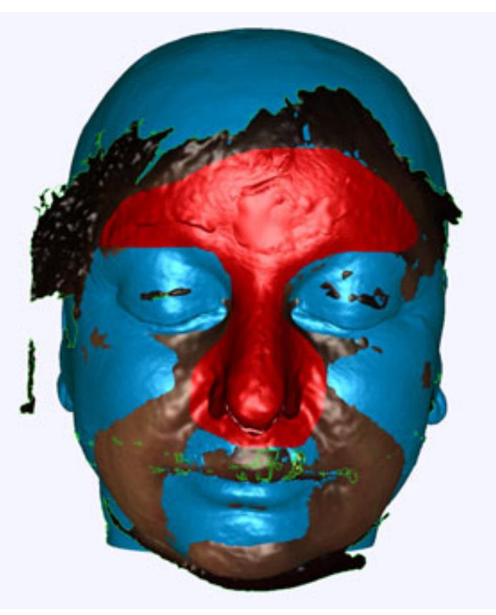 —the alignment of two meshes based on the “nose and