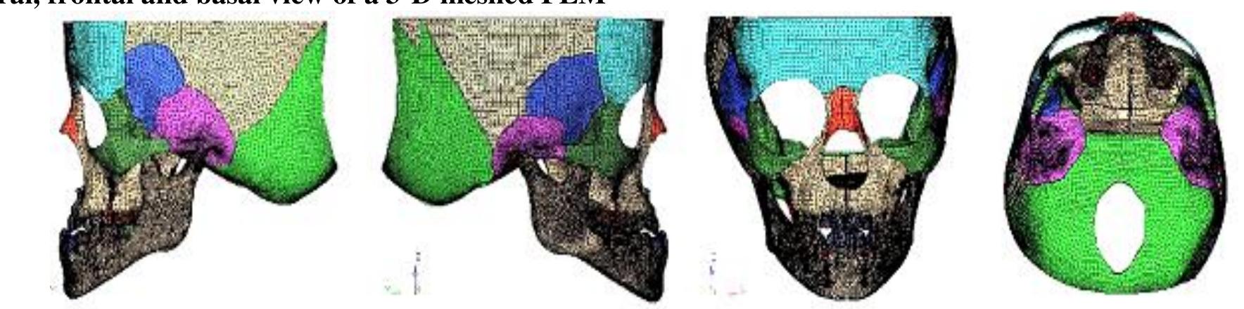 Figure 1 - FINITE ELEMENT ANALYSIS (FEA) WITH ITS