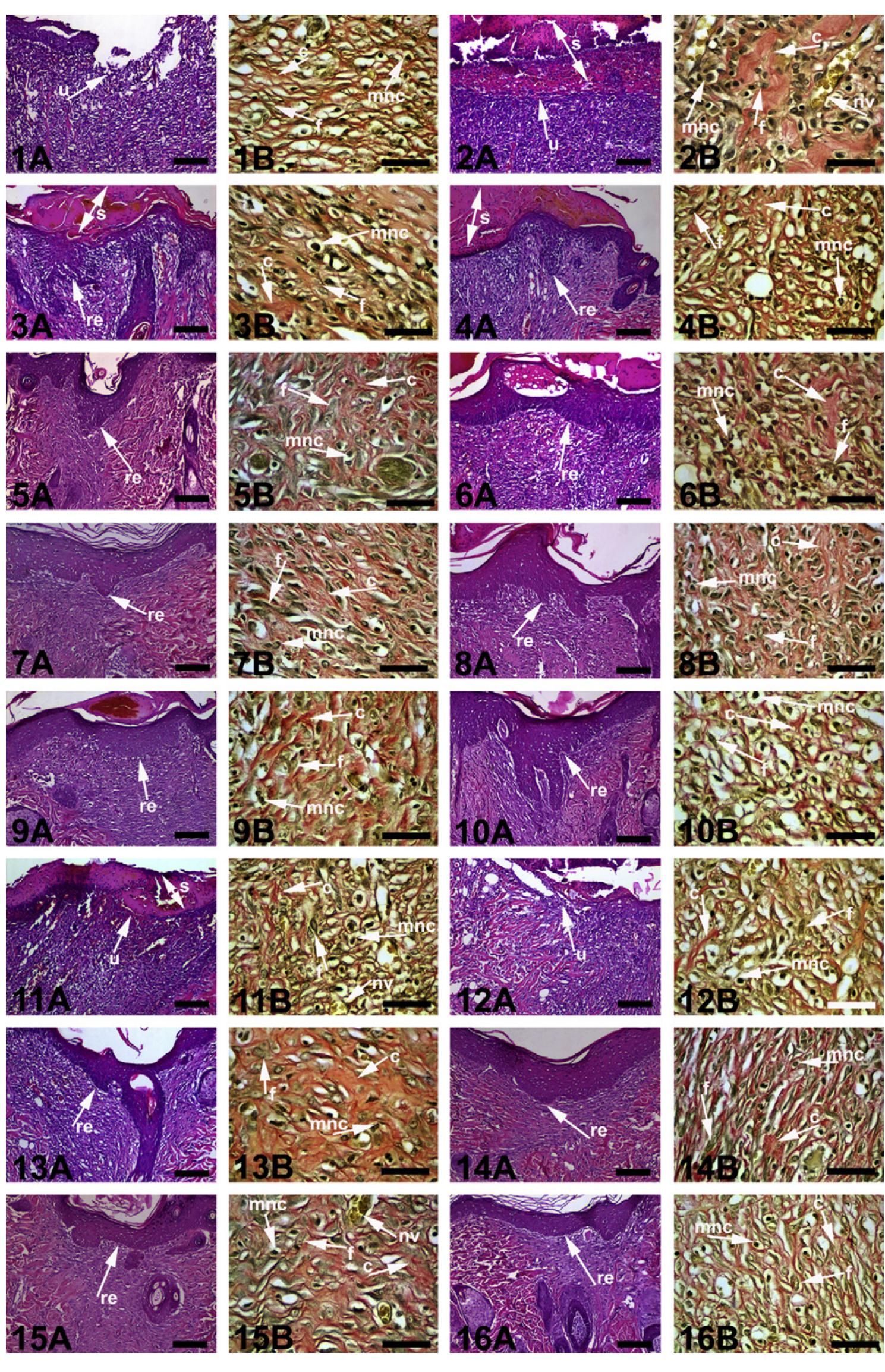 Histopathological view of wound healing and epidermal/dermal