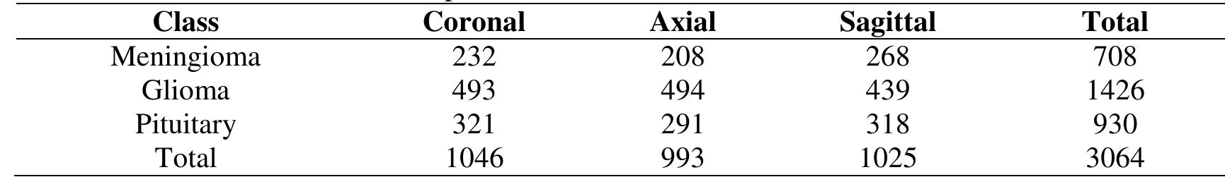 Specification of the mri brain tumor dataset table 3