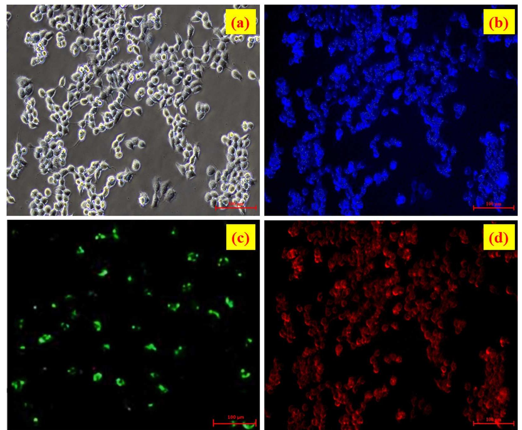 In vitro confocal microscopy images of mcf-7 cells treated