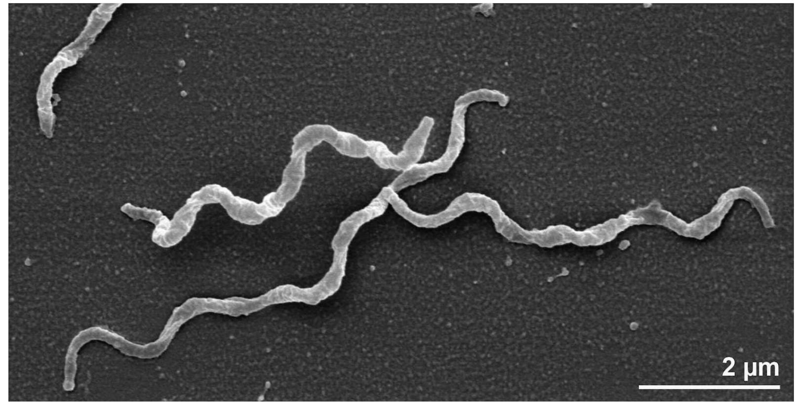 Scanning electron micrograph of t. succinifaciens 6091' the