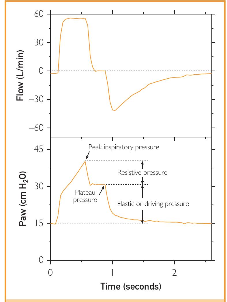 Figure 1 - from Mechanical Ventilation: State of the Art