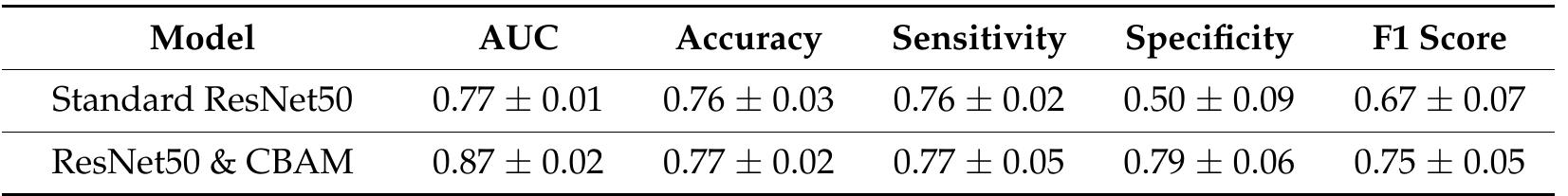 Performance comparison between two resnet50 models with and