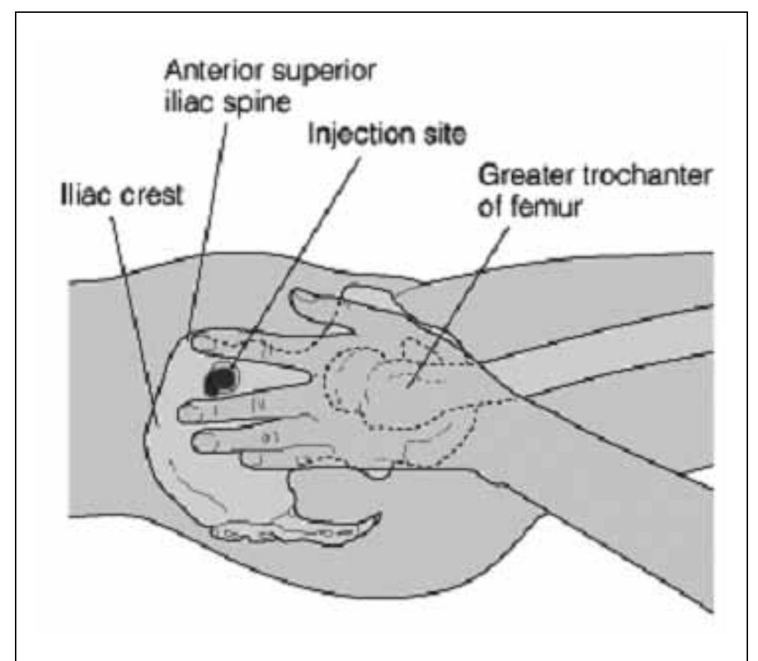 Ventrogluteal region, the palm of the opposing hand is