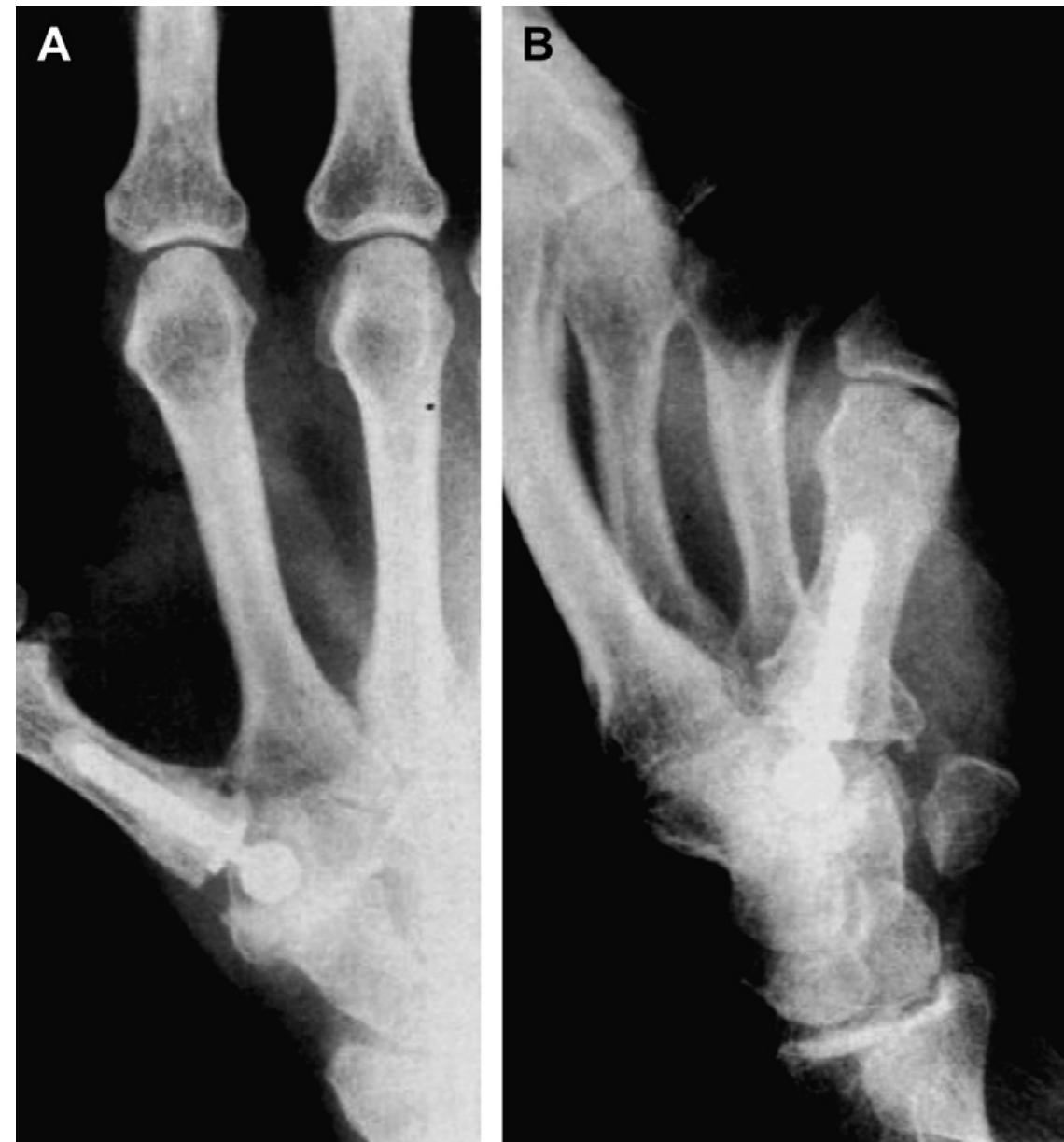 Posteroanterior (a) and lateral (b) radiographs of the right