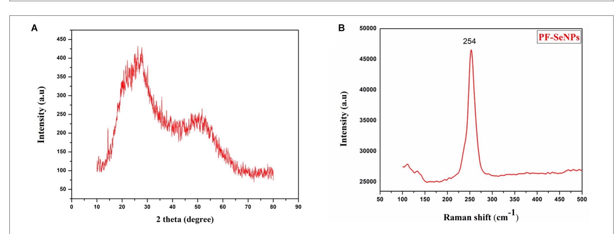 A X Ray Diffraction Xrd Pattern And B Raman