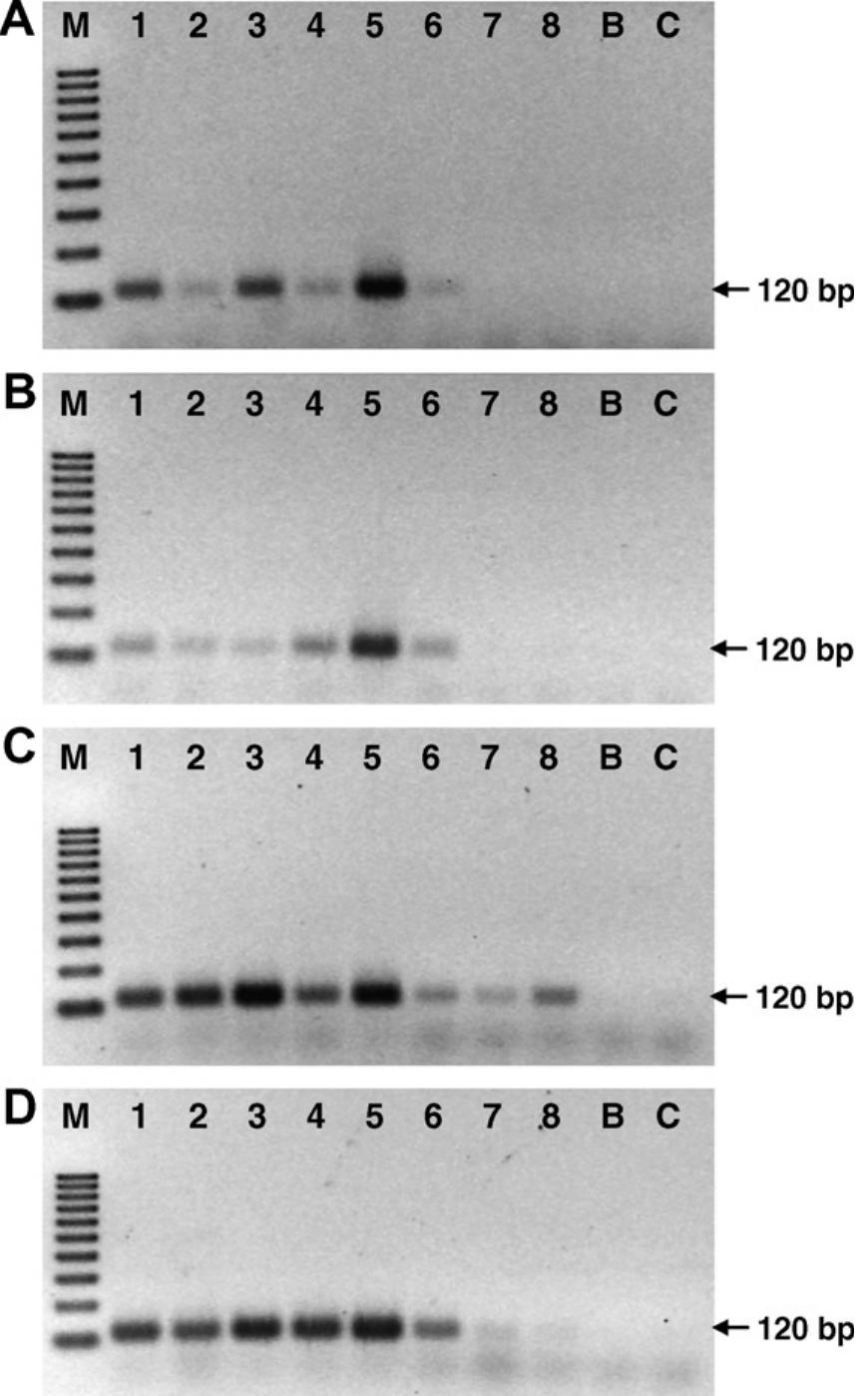 Agarose gel electrophoresis of pcr products of soybean based