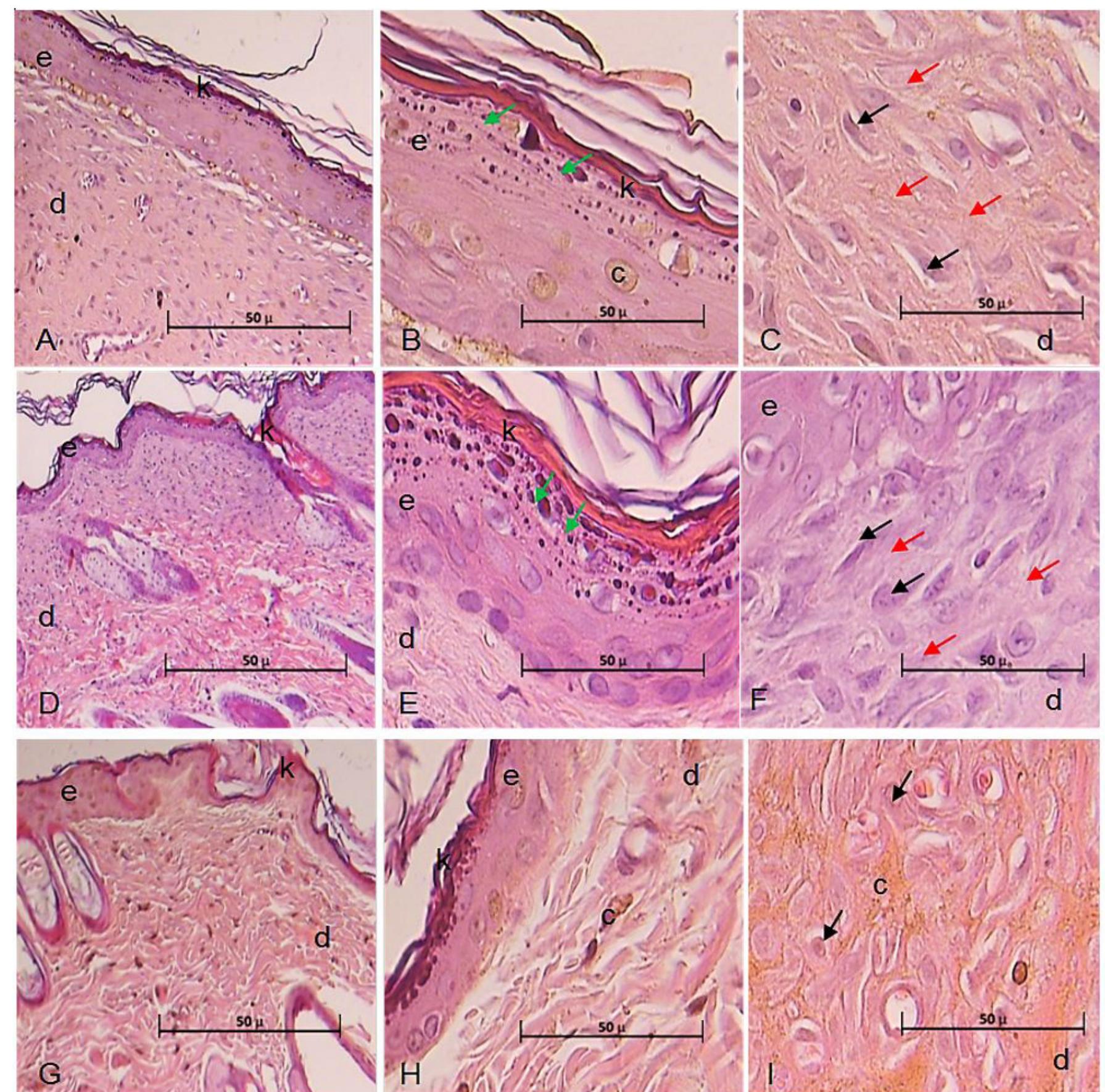 Photomicrograph of histological sections of rats’ skin