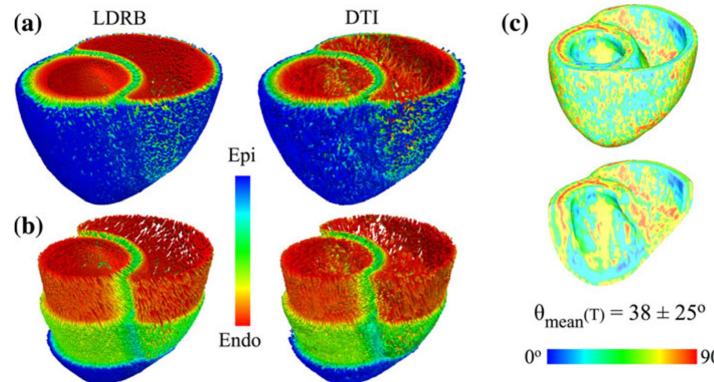 The ldrb and dti-derived transverse direction (7) in the