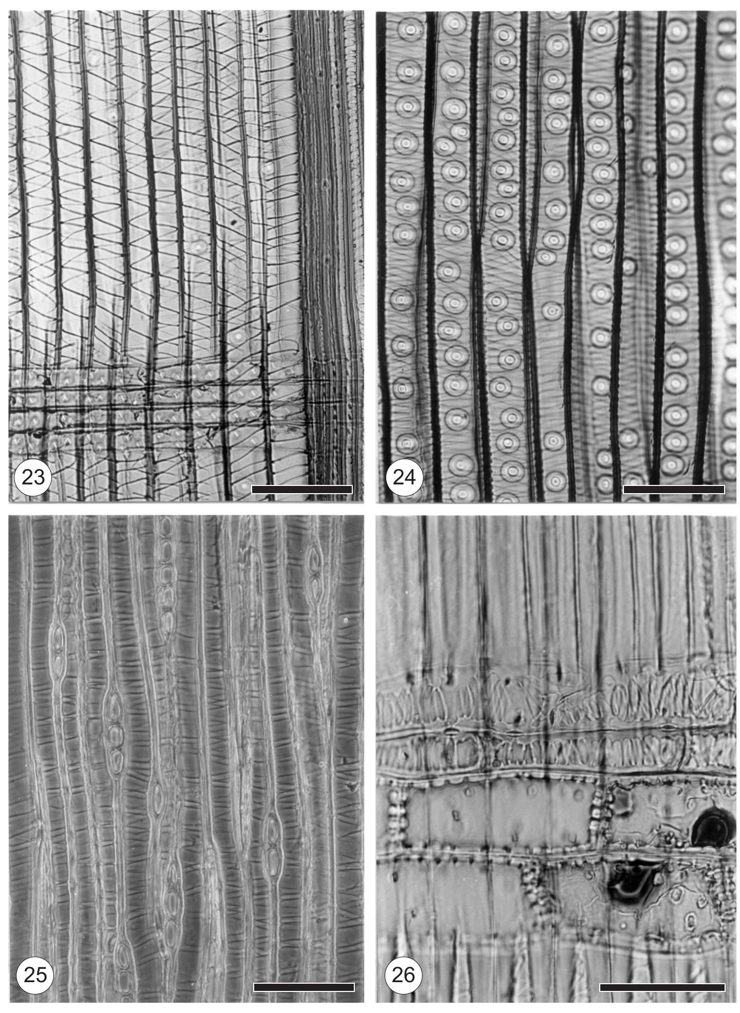 -25. helical thickenings in longitudinal tracheids (feature