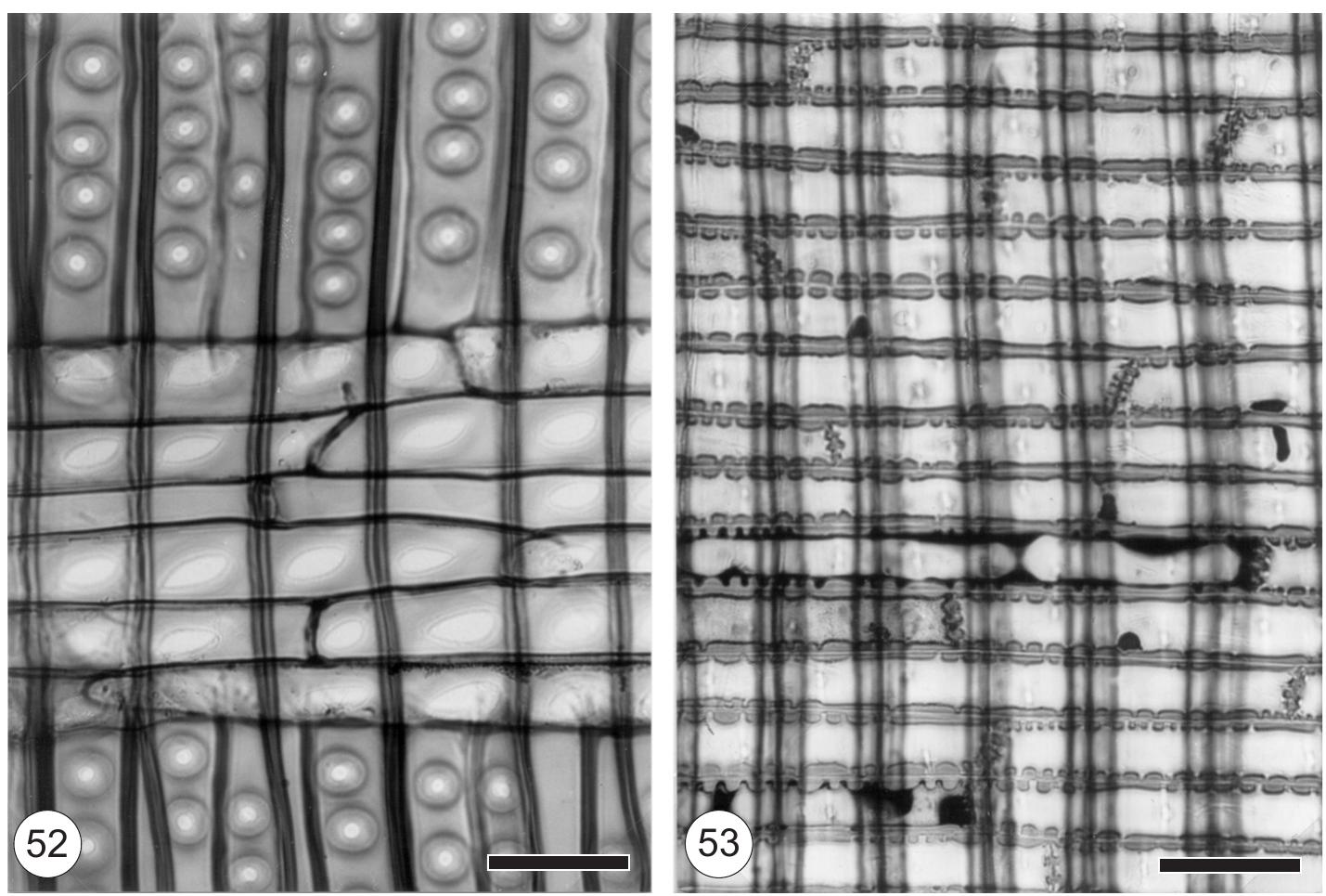 & 53. horizontal walls of ray parenchyma cells, radial