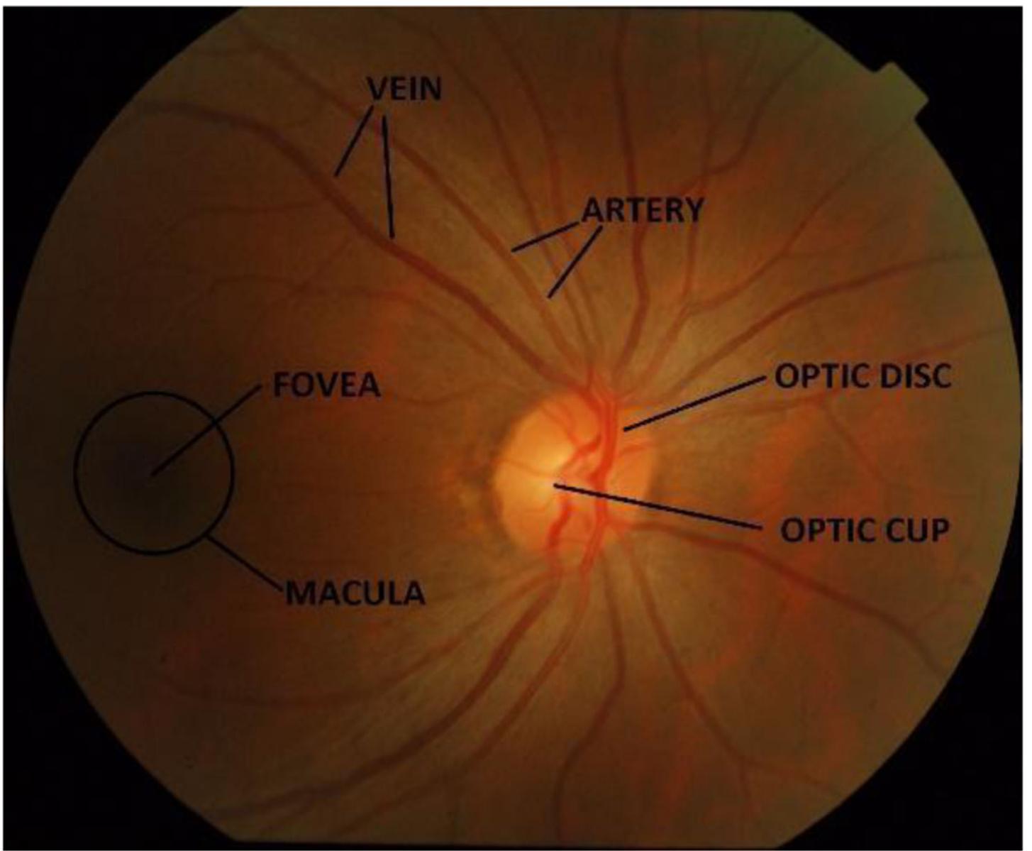 A fundus image showing various features of the eye — in