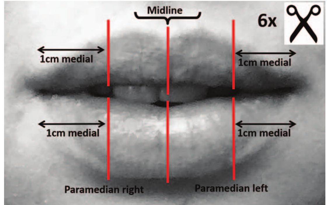 Schematic of the dissection procedure, provided in the