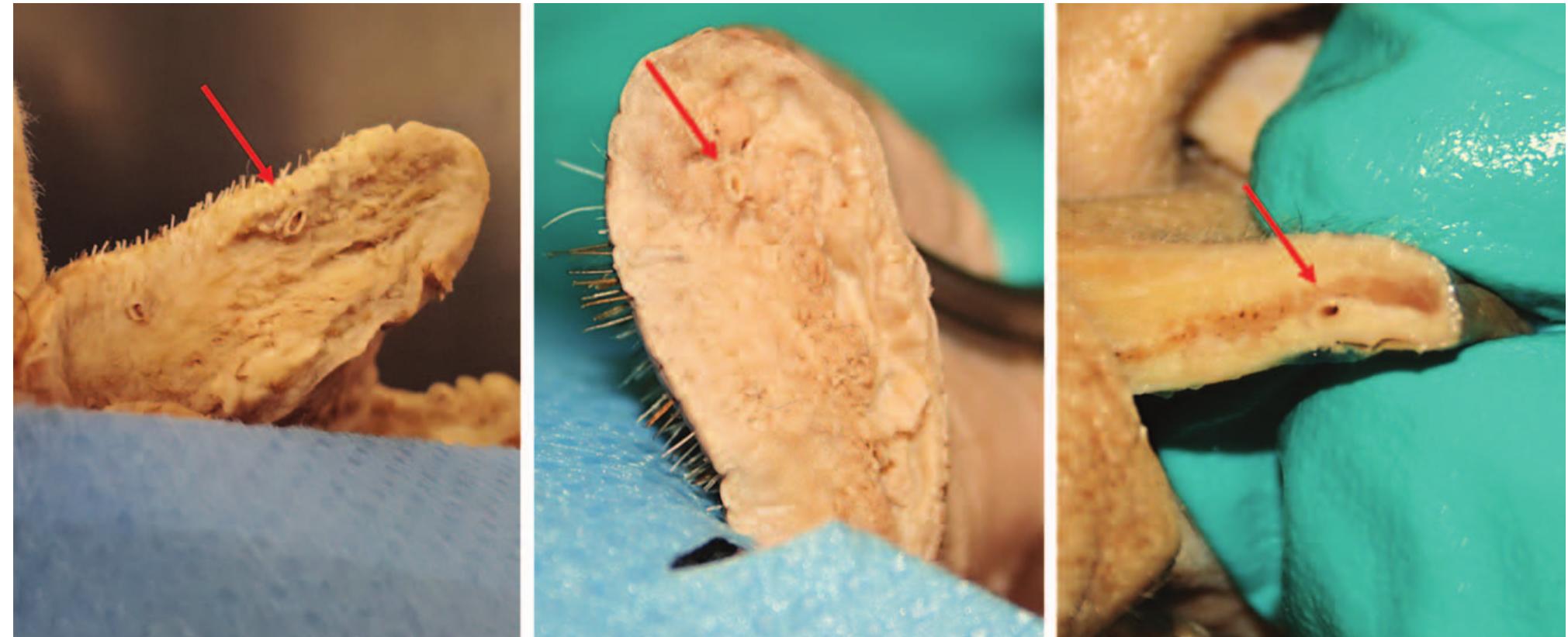 Anatomical dissection of the position of the superior and