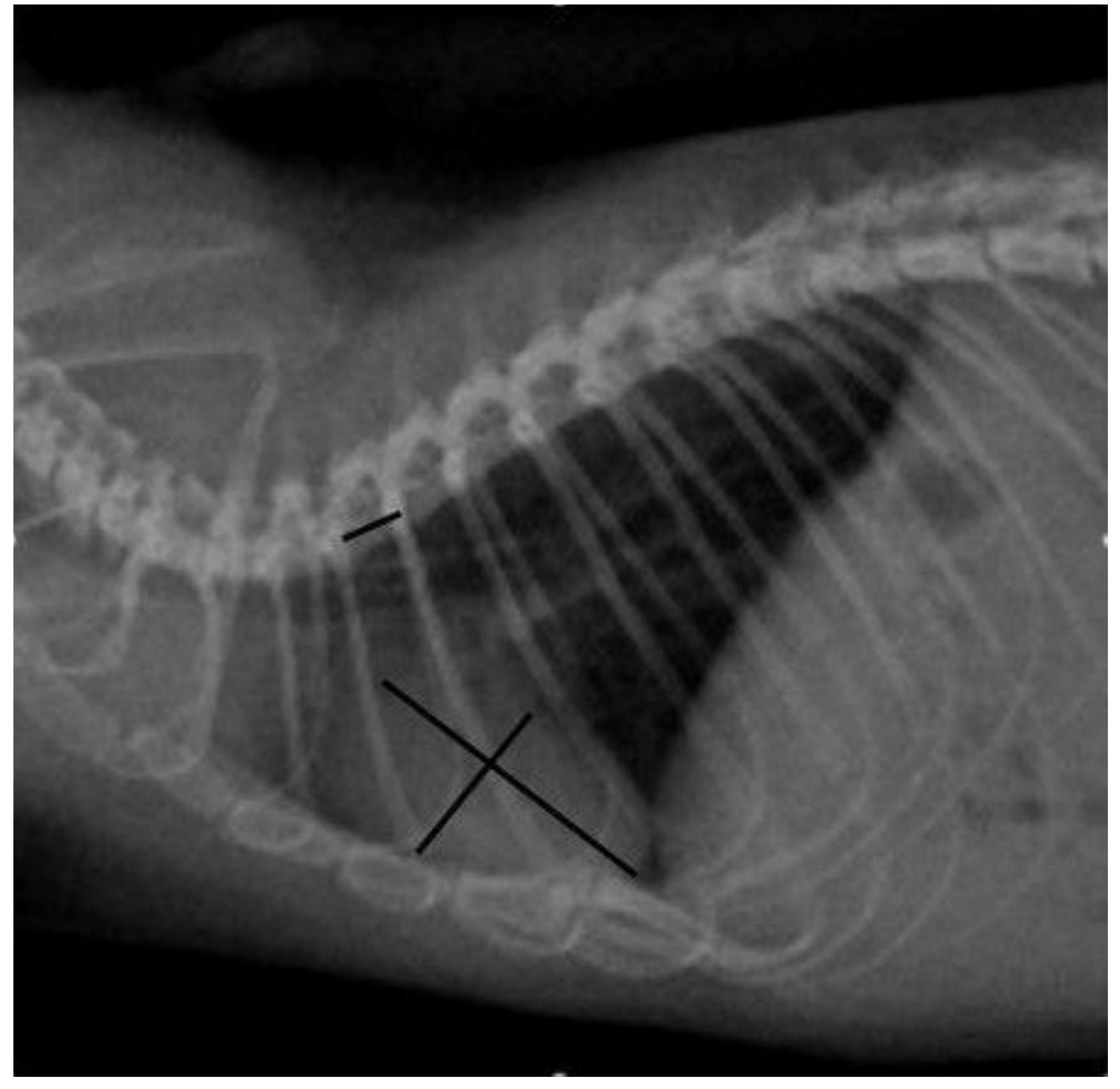 Figure 1 - Determination and correlation of vertebral heart