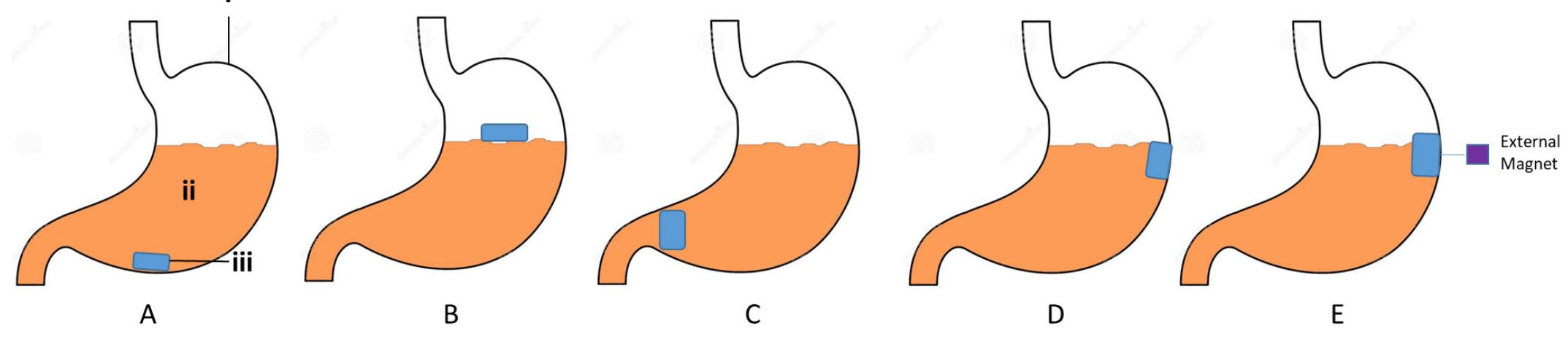 Different types of gastroretentive drug delivery system. a)