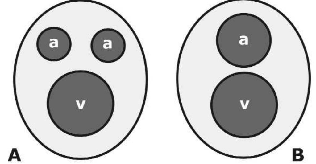 Schematic representation of the umbilical cord trans- vers