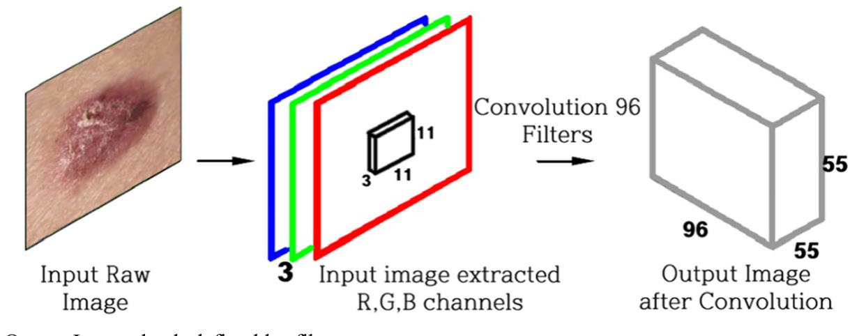 Figure 2 - The skin cancer classification using deep