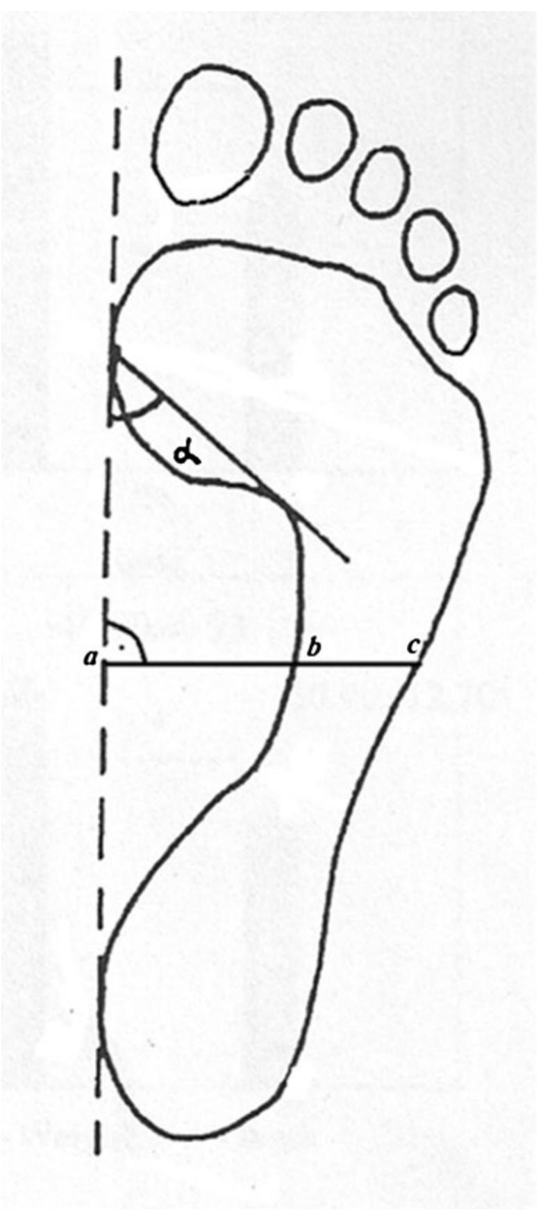 Figure 4 - from Body weight and the medial longitudinal foot
